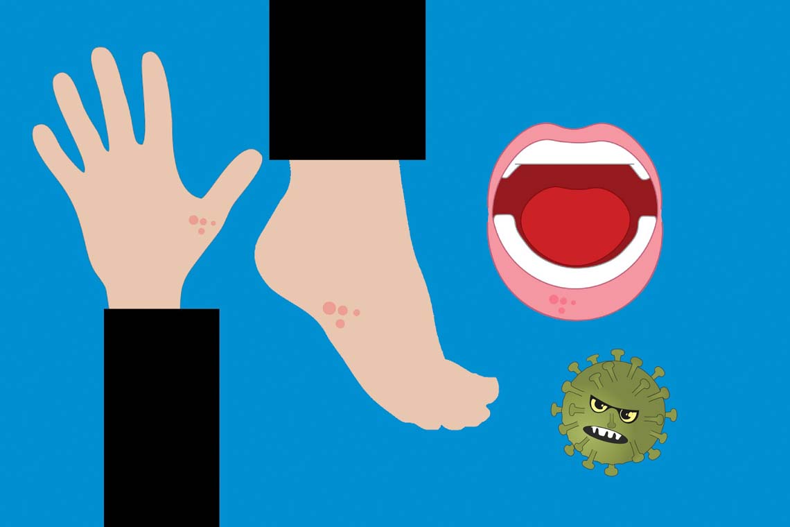 „Nesselsucht (Urtikaria) – Auslöser und Behandlungsmöglichkeiten ...